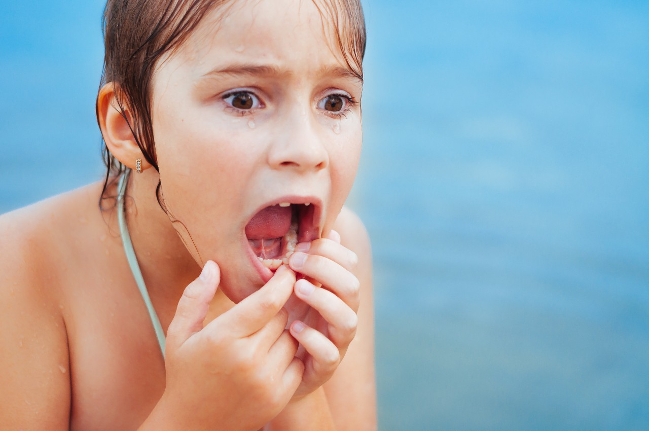 My Child Chipped a Tooth: What Should I Do? - Utah Pediatric Dentists